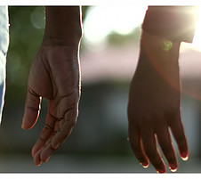 How to Treat & Cure Dry (Sensitive) Skin on Hands – Easy & Effective ...