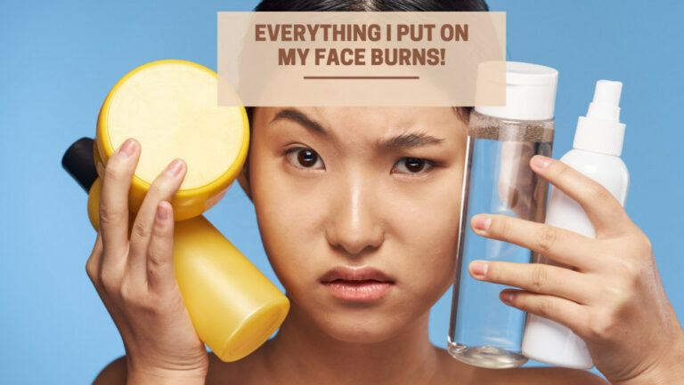 Why does everything I put on my face burns? | Web Skincare Solution